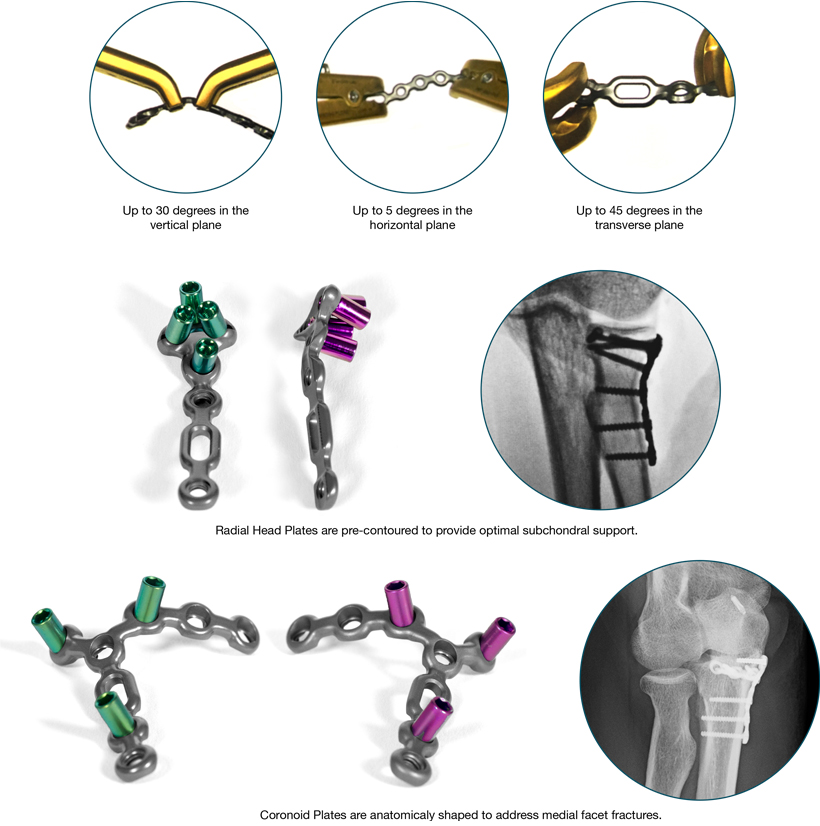 Protean Fragment Plates Skeletal Dynamics Skeletal Dynamics