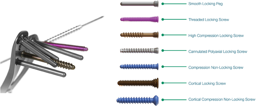Geminus Volar Distal Radius Plate - Skeletal Dynamics Skeletal Dynamics