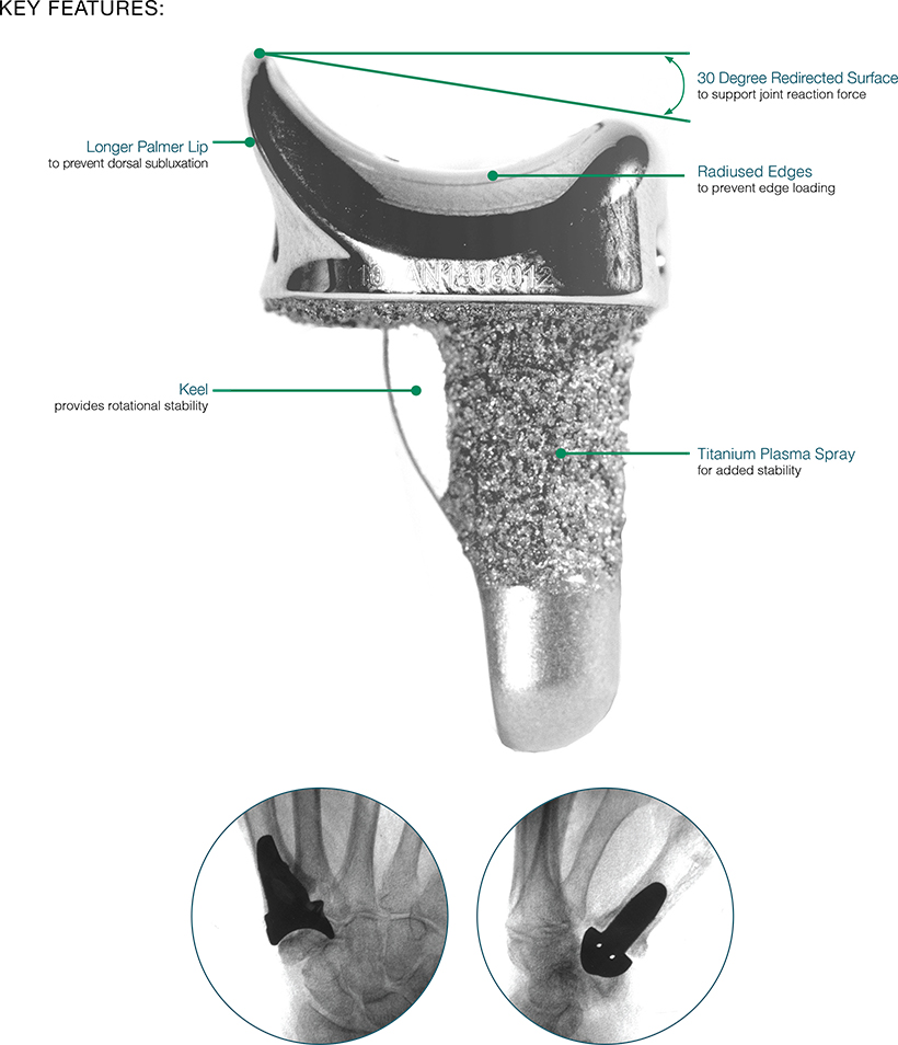 STABLYX® - Skeletal Dynamics Skeletal Dynamics