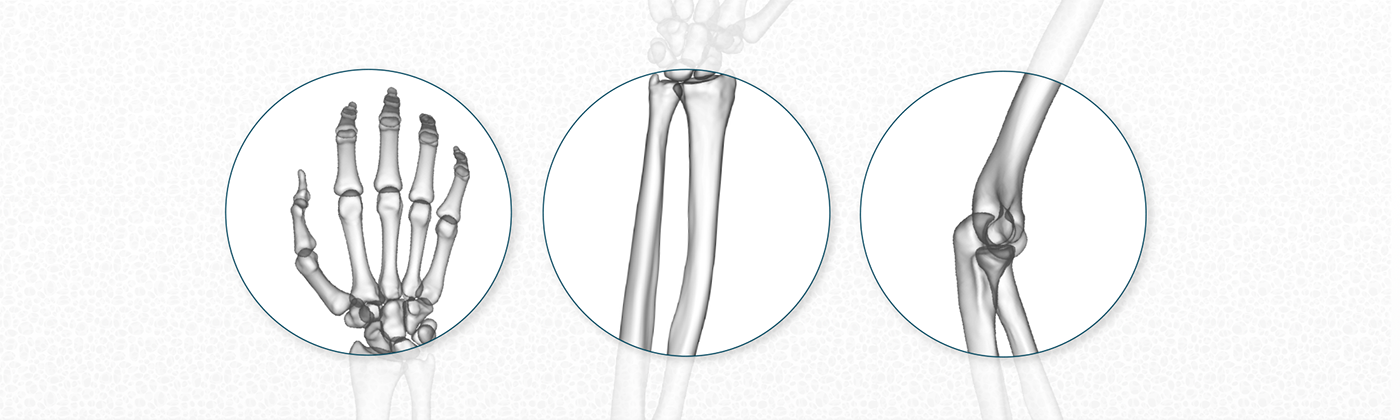 Understanding - Skeletal Dynamics