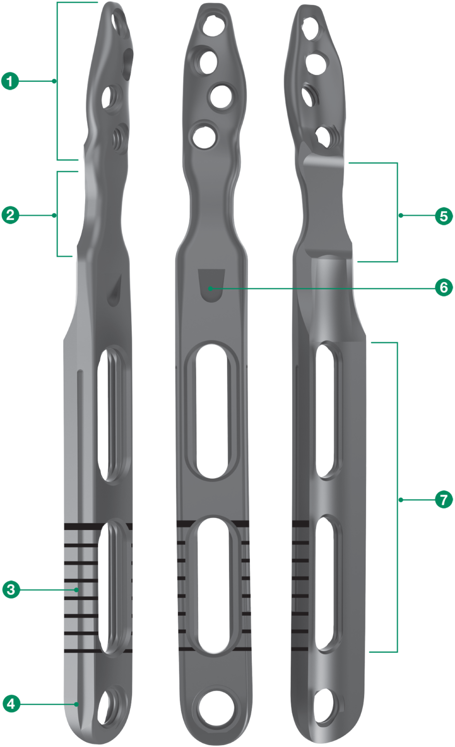 FREEFIX® Ulnar Shortening System - Skeletal Dynamics